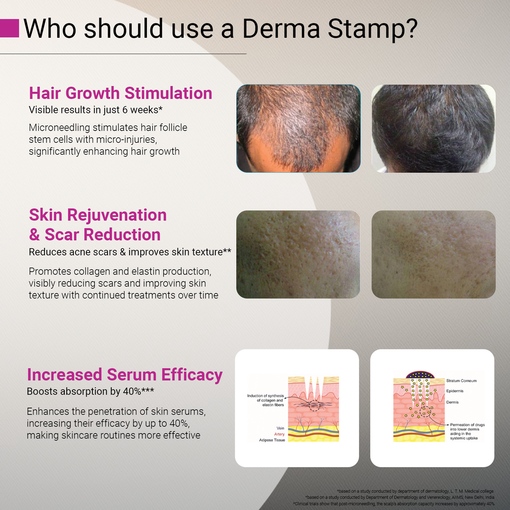Derma Stamp | Adjustable Titanium Coated Needles - 0.25mm to 3mm